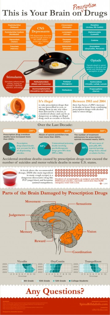 How brain responds to prescription drugs – Infographics